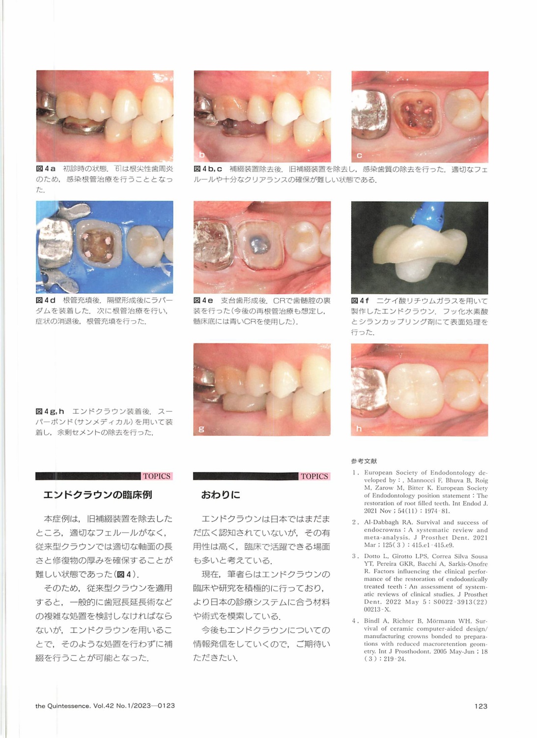 エンドクラウン | 写真共有サービス 30days Album